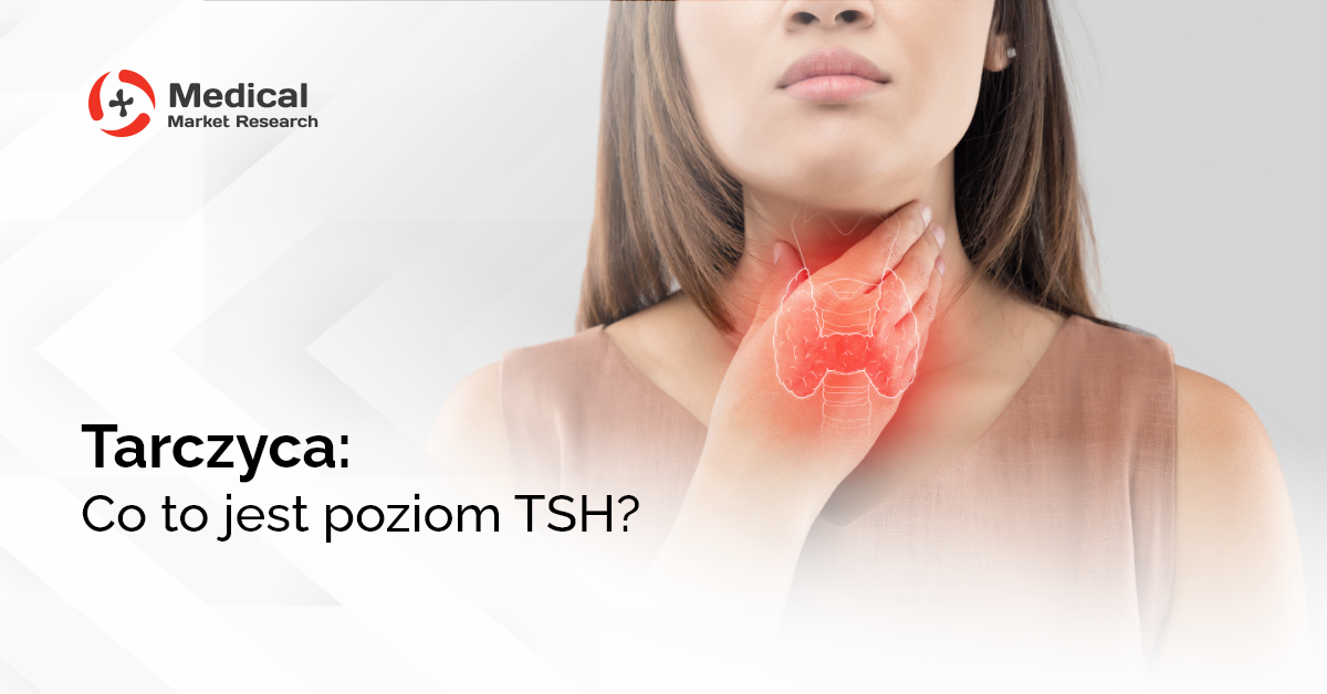 Tarczyca: Co to jest poziom TSH?